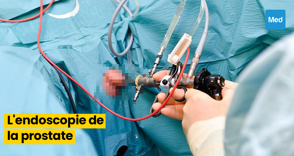 Comprendre l'Endoscopie de la Prostate - Magazine Médical
