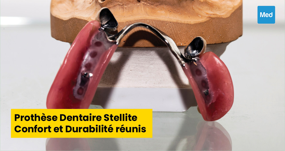 Prothèse Dentaire Stellite : Confort et - Magazine Médical
